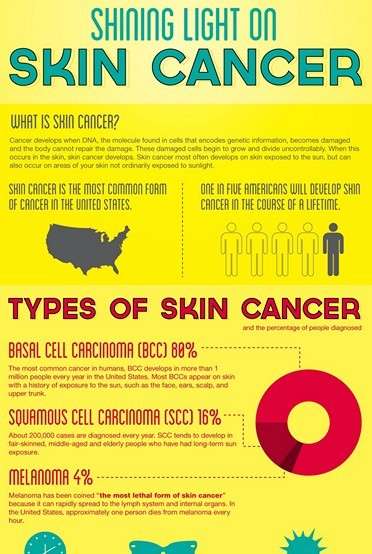 Infographics
